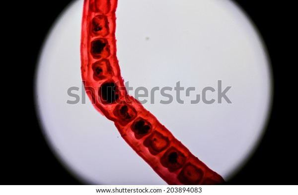 Silkworm Moth Larva Under Microscope Magnification Stock Photo ...