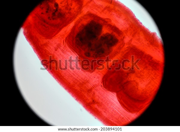 Silkworm Moth Larva Under Microscope Magnification 스톡 사진 203894101 ...