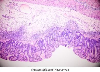 Simple Columnar Epithelium Under Microscope Stock Photo 462424936 ...