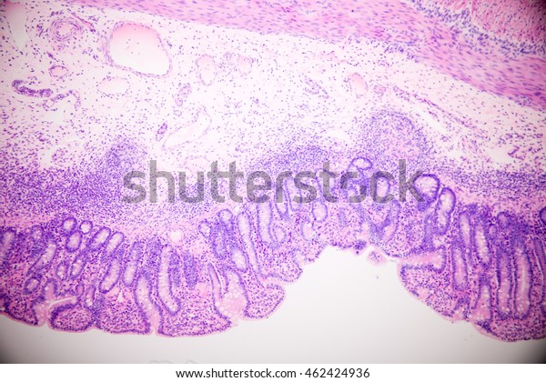 Simple Columnar Epithelium Under Microscope Stock Photo 462424936 ...