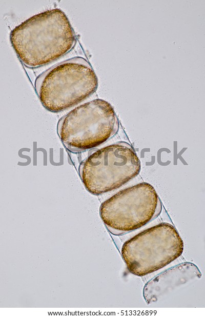 Skeletonema Diatom Under Microscope View Stock Photo (Edit Now) 513326899