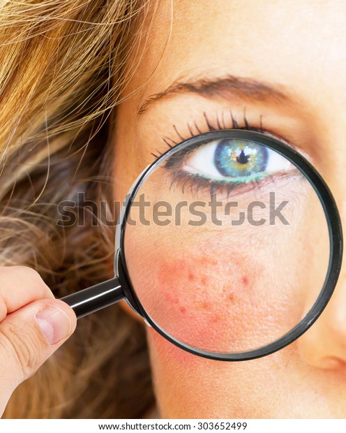 Skin Problems Stock Photo 303652499 | Shutterstock