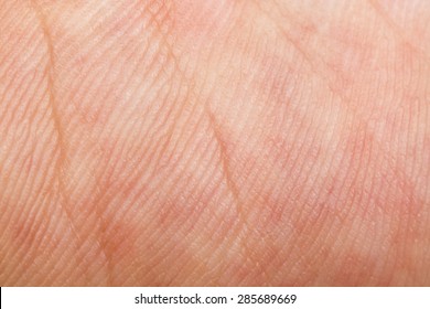 52 Ruddy complexion Images, Stock Photos & Vectors | Shutterstock