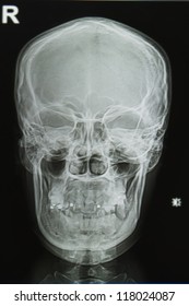 Front Face Skull Xray Image Stock Photo 217788271 | Shutterstock