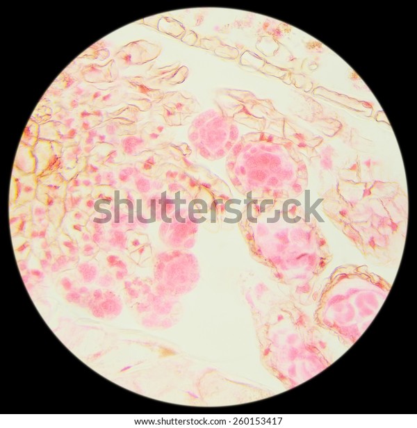 Slice Fern Leaf Under Microscope Fern Stock Photo 260153417 | Shutterstock