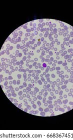 377 Small Lymphocyte Images, Stock Photos & Vectors | Shutterstock
