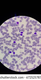 377 Small Lymphocyte Images, Stock Photos & Vectors | Shutterstock