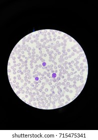377 Small Lymphocyte Images, Stock Photos & Vectors | Shutterstock