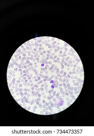 377 Small Lymphocyte Images, Stock Photos & Vectors | Shutterstock