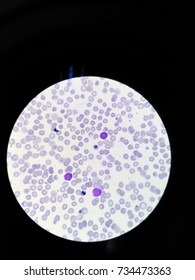 377 Small Lymphocyte Images, Stock Photos & Vectors | Shutterstock