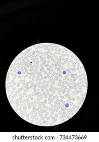 377 Small Lymphocyte Images, Stock Photos & Vectors | Shutterstock