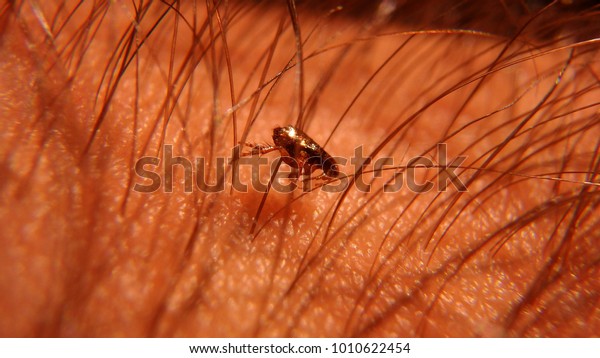 Small Rat Flea Trying Bite On Stock Photo (Edit Now) 1010622454