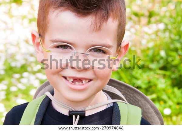 Smiling Boy Without Front Teeth Outdoors Stock Photo 270974846 ...