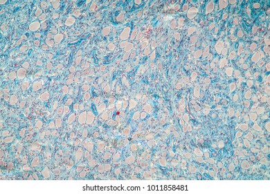 Soft Palate Tissue Under Microscope 100x Foto stock 1011858481 ...