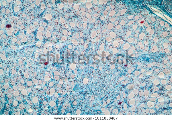 Soft Palate Tissue Under Microscope 100x Stock Photo 1011858487 ...