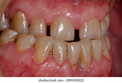 812 Anterior teeth Images, Stock Photos & Vectors | Shutterstock
