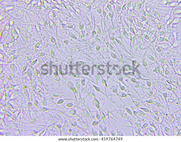 Sperm Microscopic View Real Material Image Stock Photo 459764749 ...
