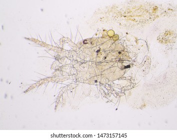 Marine Aquatic Plankton Under Microscope View Stock Photo (Edit Now ...