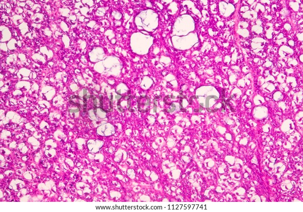 Spinal Cord Nerve Cell Section Under Stock Photo 1127597741 | Shutterstock