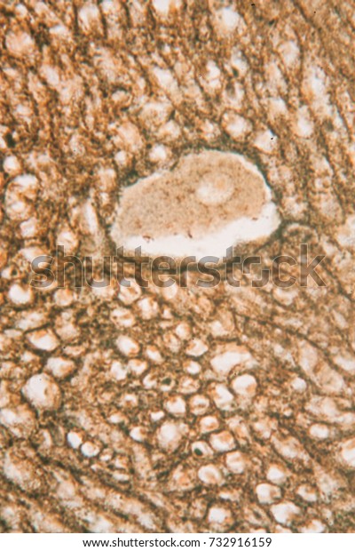 Spinal Cord Under Microscope 100x Stock Photo 732916159 | Shutterstock