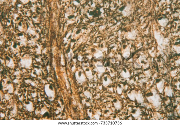 Spinal Cord Under Microscope Stock Photo 733710736 | Shutterstock