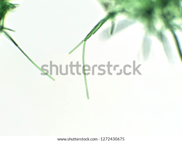 Spirulina Algae Under Microscopic View Cyanobacteria Stock Photo (Edit ...
