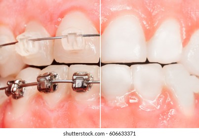 210 Teeth Smile Split Images, Stock Photos & Vectors | Shutterstock