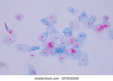 Squamous Epithelial Cells Under Microscope View Stock Photo (Edit Now ...