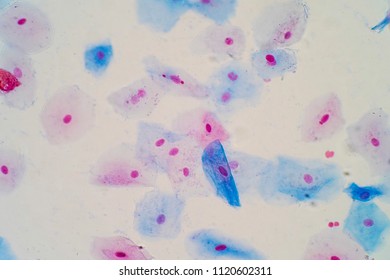Squamous Epithelial Cells Under Microscope View Stock Photo (Edit Now ...