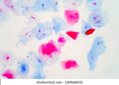 Squamous Epithelial Cells Under Microscope View Stock Photo 1204668331 ...