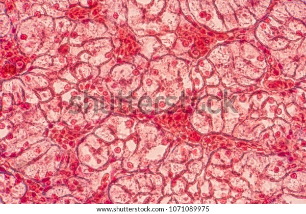 Células epiteliales escamosas bajo la visión del microscopio para la ...