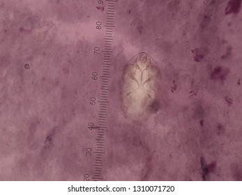 Large Abdominal Scar Patient After Abdomen Stock Photo 793755646 ...