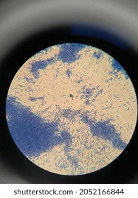 Stained Bacteria Bacilli Under Microscope Stock Photo 2052166844 ...