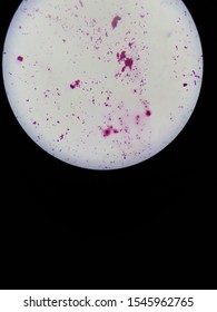Staining Grampositive Bacteria Seen Microscope Stock Photo 1545962765 ...