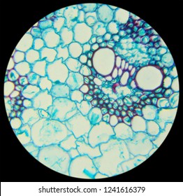 Stalk Cereal Crosssection Under Microscope Corn Stock Footage Video ...