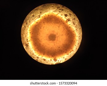 Staphylococcus Aureus Colony Under Microscope Stock Photo (Edit Now ...