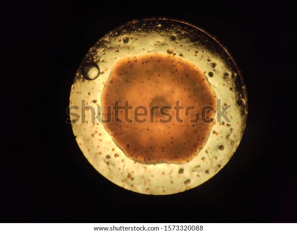 Staphylococcus Aureus Colony Under Microscope Stock Photo 1573320088 ...