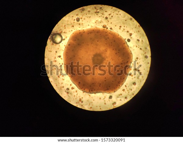 Staphylococcus Aureus Colony Under Microscope Stock Photo 1573320091 ...