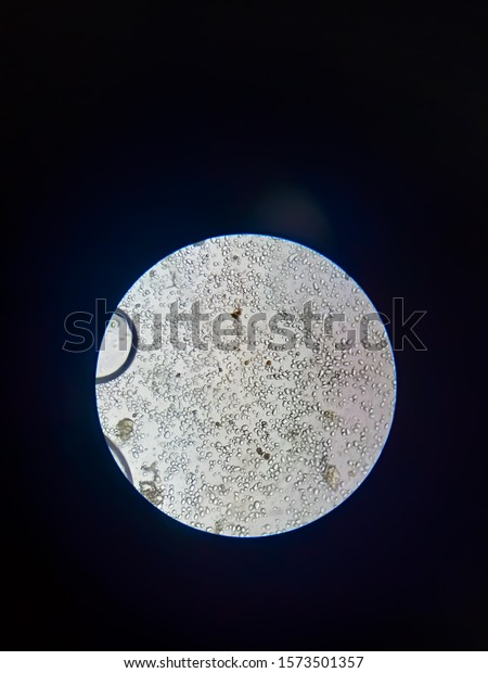 Starch Granules Ginger Under Microscope Stock Photo 1573501357 ...