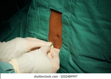 Step By Step Procedure Preparing Performing Stock Photo (Edit Now ...