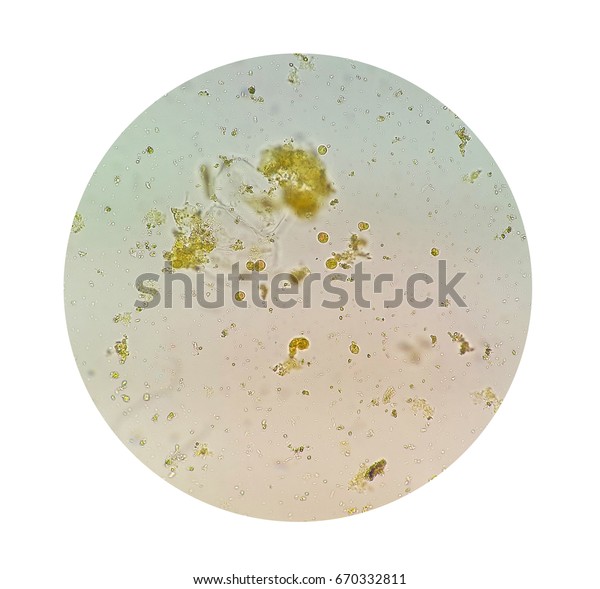 Stool Parasites Examination Test Parasites Eggs Stock Photo (Edit Now ...