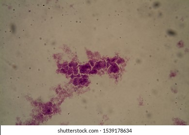 Streptococcus Lactis Bacteria Under Microscope 400x Stock Photo ...
