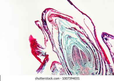 Strobile Female Pine Under Microscope Stock Photo 1007394031 | Shutterstock