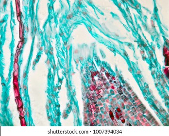 Strobile Female Pine Under Microscope Stock Photo 1007394034 | Shutterstock