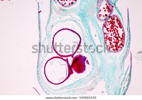 Strobilus Selaginella Under Microscope View Stock Photo 544865410 ...