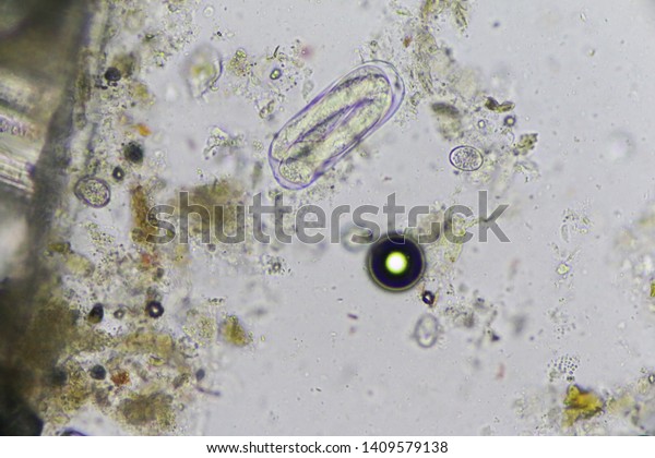 Strongyloides Spp Under Microscope Foto de stock 1409579138 | Shutterstock