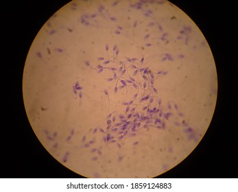 Candida Pseudohypae Present Sputum Koh Mount Stock Photo 1596399400 ...