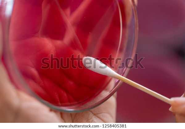 Study Bacteria Staphylococcus Aureus Human Nose Stock Photo 1258405381 ...