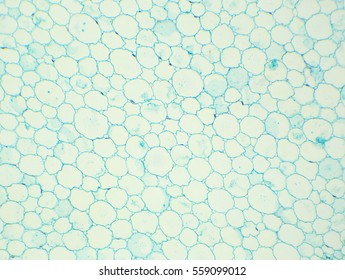 Sunflower Stalk Crosssection Under Microscope Helianthus Stock Footage ...