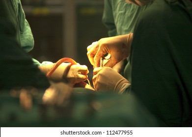 33,033 Close up operation Images, Stock Photos & Vectors | Shutterstock